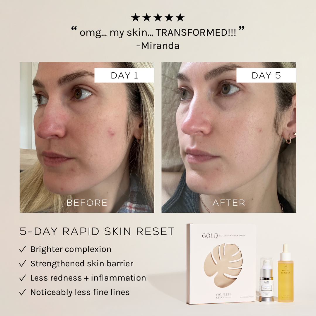 Complete Skin Makeover - Natural Skin Care